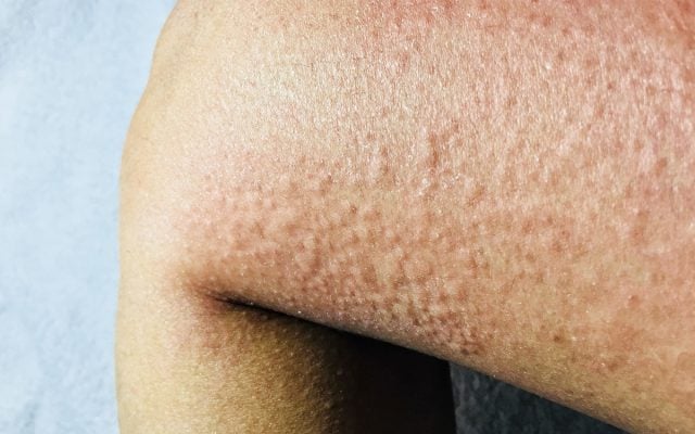 Boli de la aer condiționat: rinite, conjunctivite, sinuzite și alergie ...