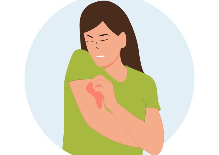 Urticarie: tipuri, simptome și metode de tratament eficiente