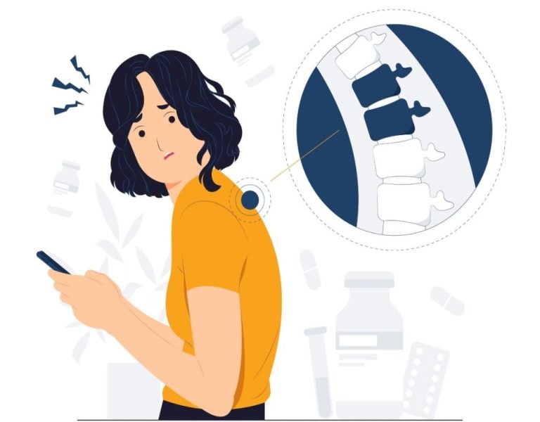 Cifoza la adulți și copii. Exerciții care corectează cocoașa