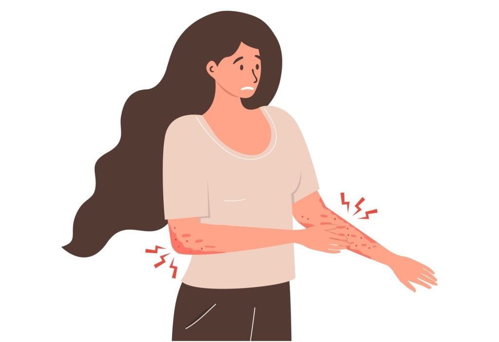 Iritații ale pielii: tipuri, cauze, imagini și soluții de la dermatolog